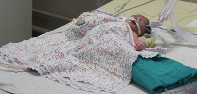 Bir günlük bebek hayata 100 dakikalık molayla başladı